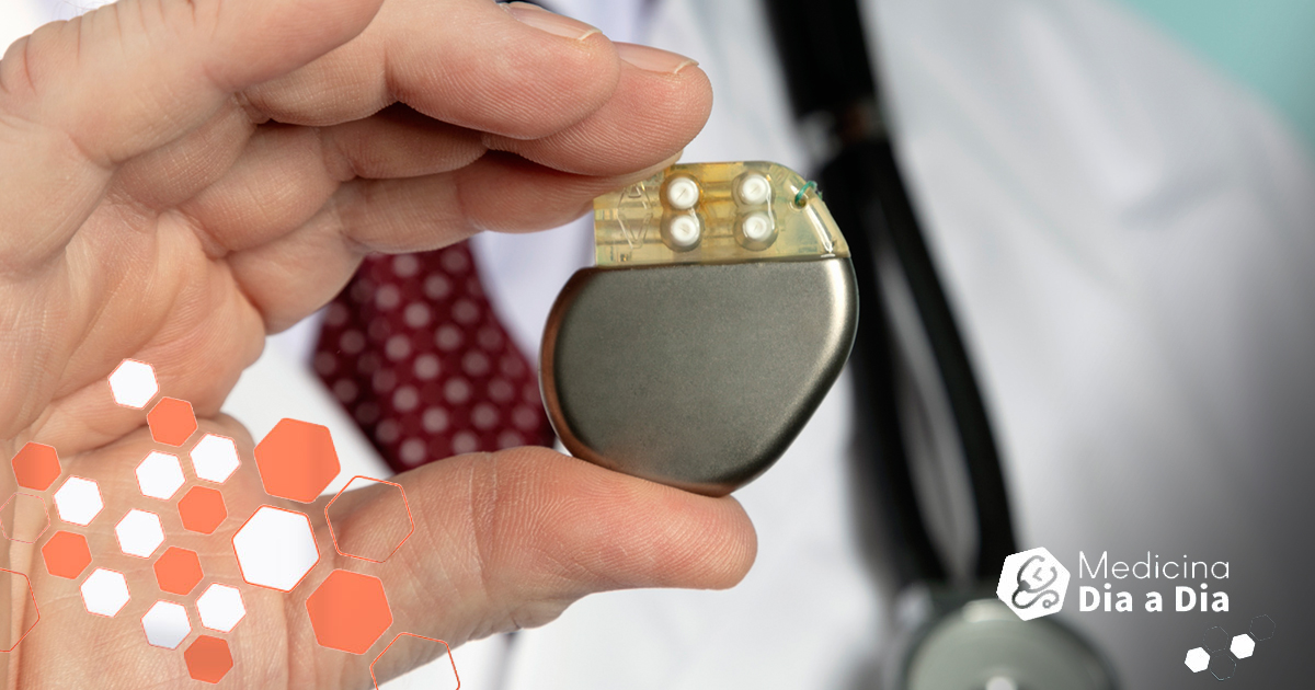 Evolução tecnológica do marcapasso - Medicina dia a dia
